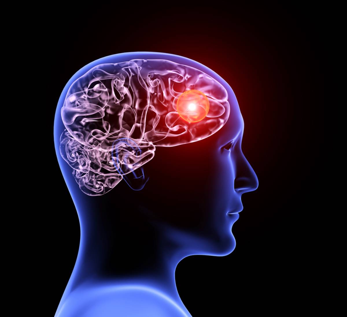 Hereditary brain and nervous system diseases - iphonegurues.com